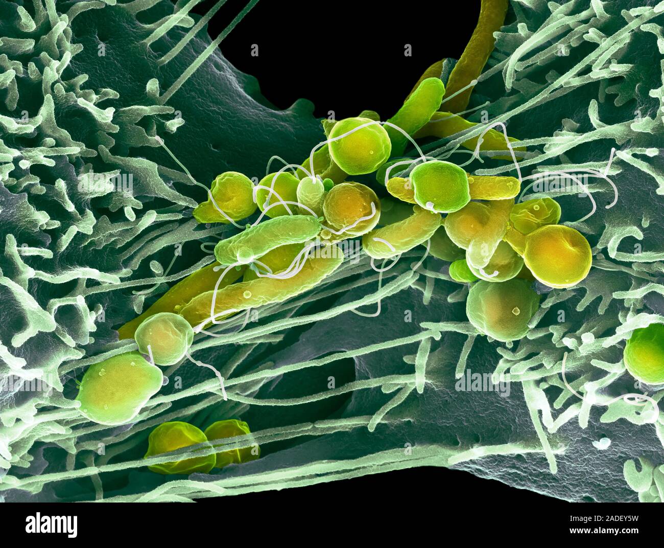 Helicobacter pylori bacteria (yellow/green), coloured scanning electron ...