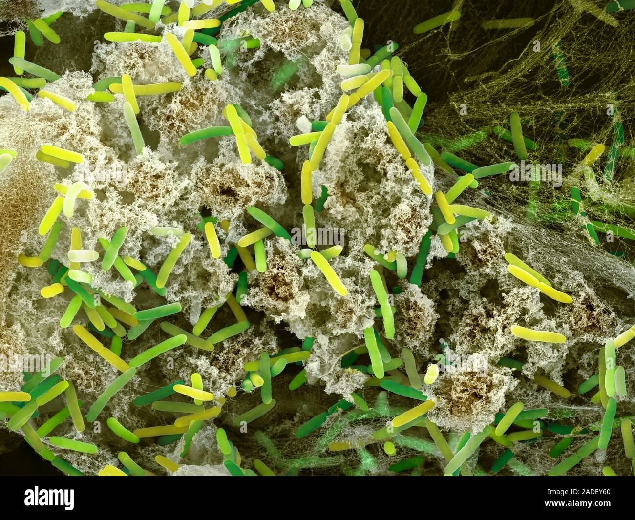 Pseudomonas aeruginosa bacteria, coloured scanning electron micrograph ...