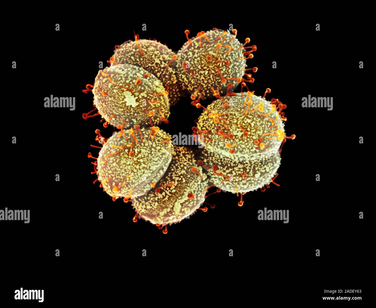 Bacteriophages attacking Streptococcus bacteria. Coloured scanning electron micrograph (SEM) of ...
