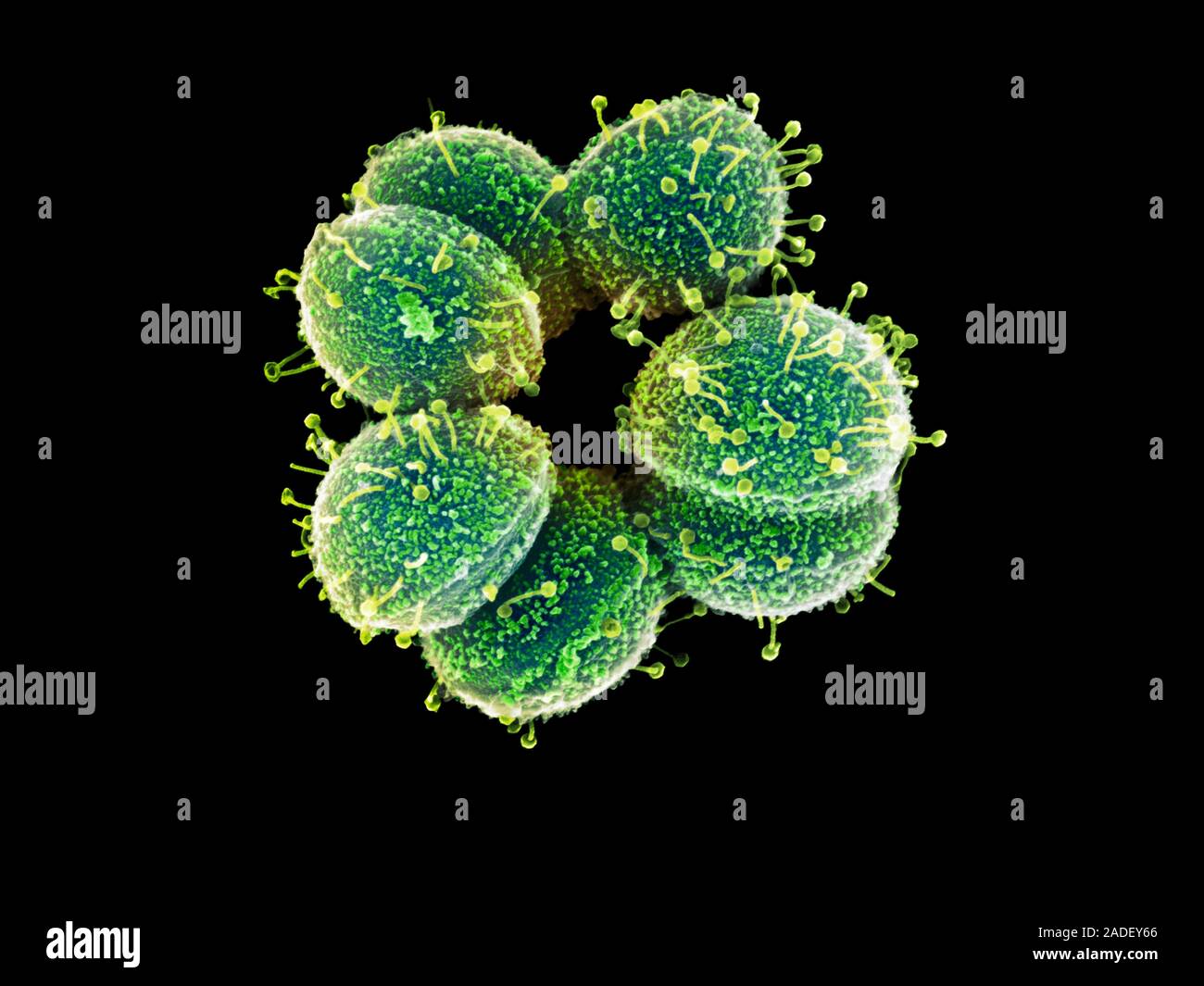 Bacteriophages attacking Streptococcus bacteria. Coloured scanning ... Bacteriophages attacking Streptococcus bacteria. Coloured scanning ...