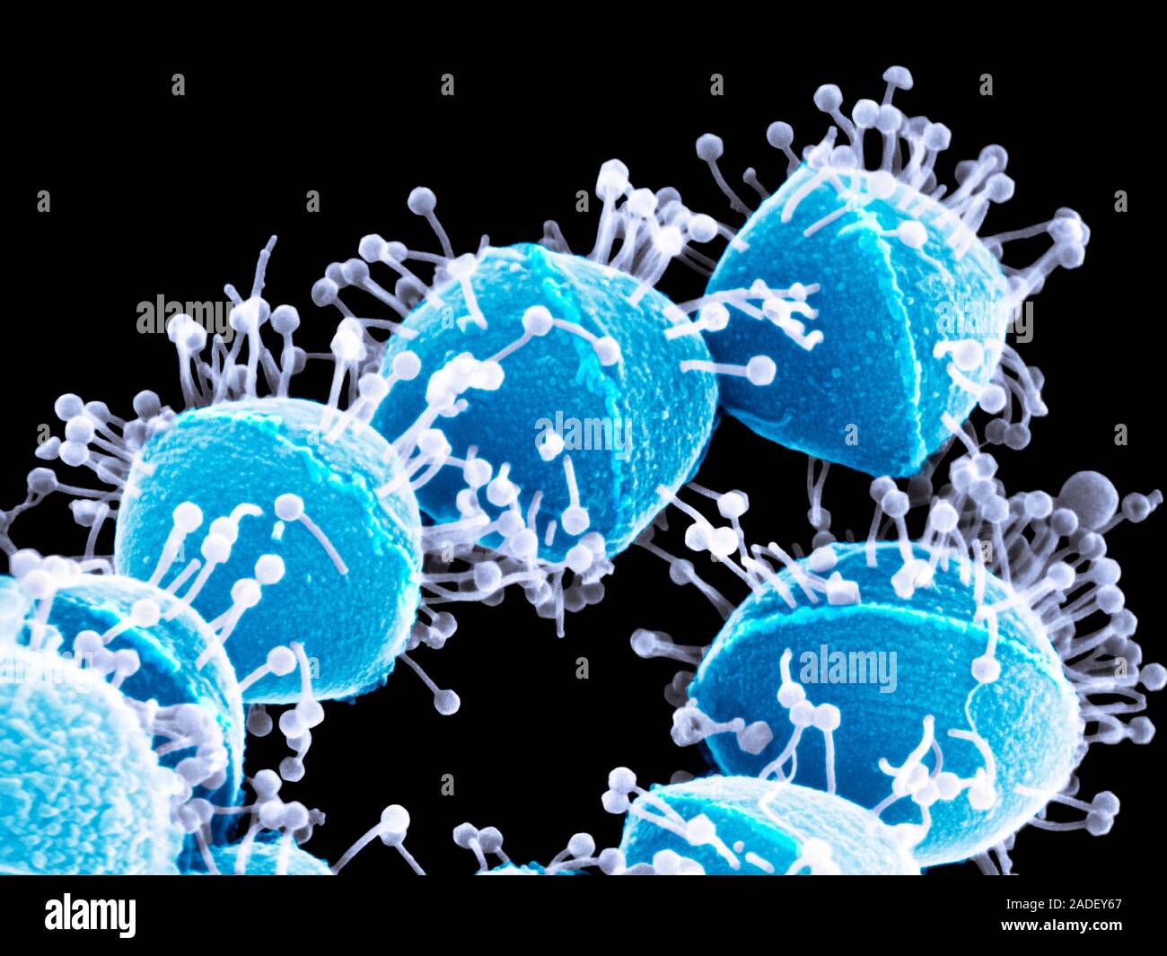 Bacteriophages attacking Streptococcus bacteria. Coloured scanning ...