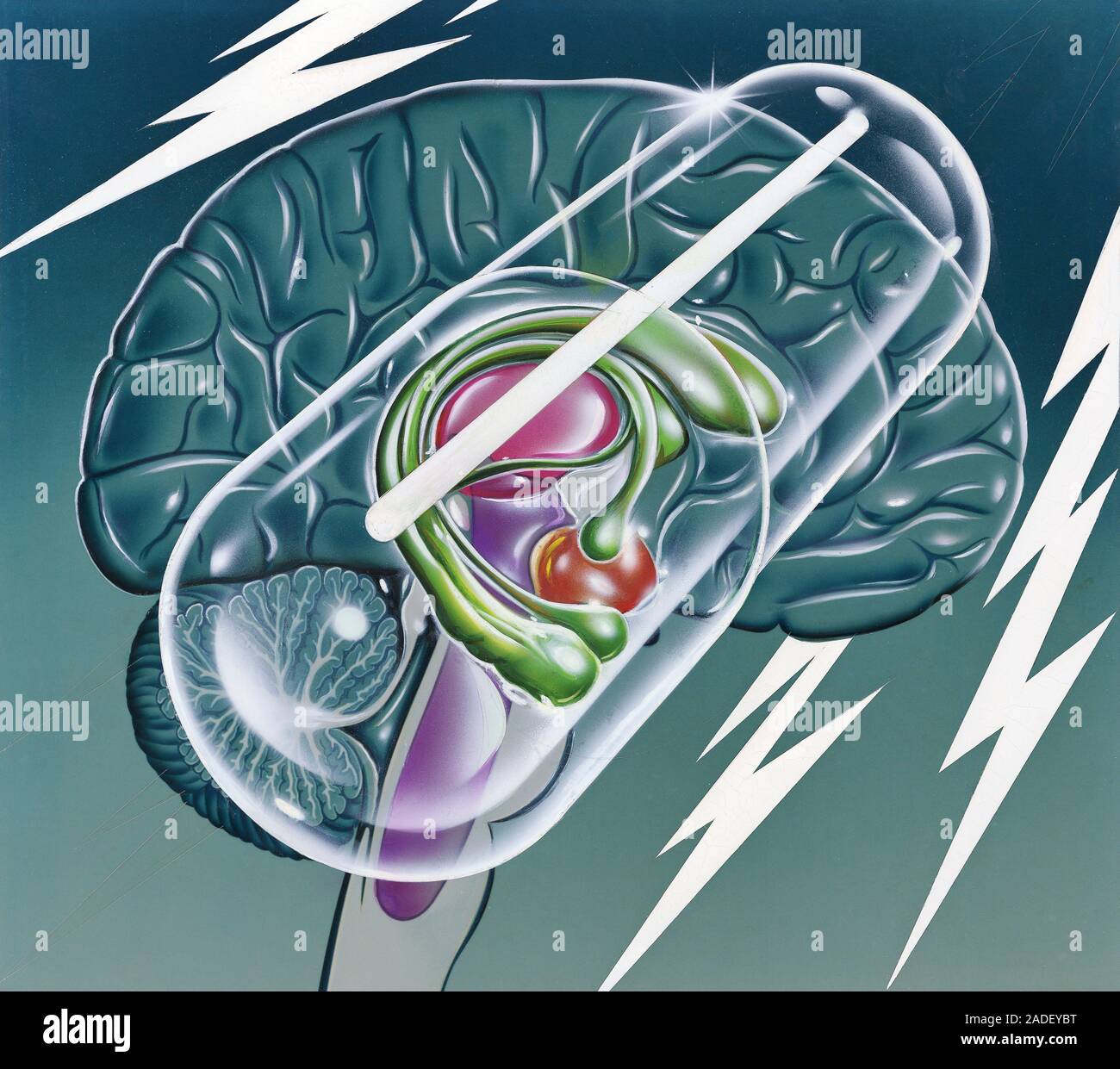 Treatment of depression, conceptual image. The limbic system of the ...