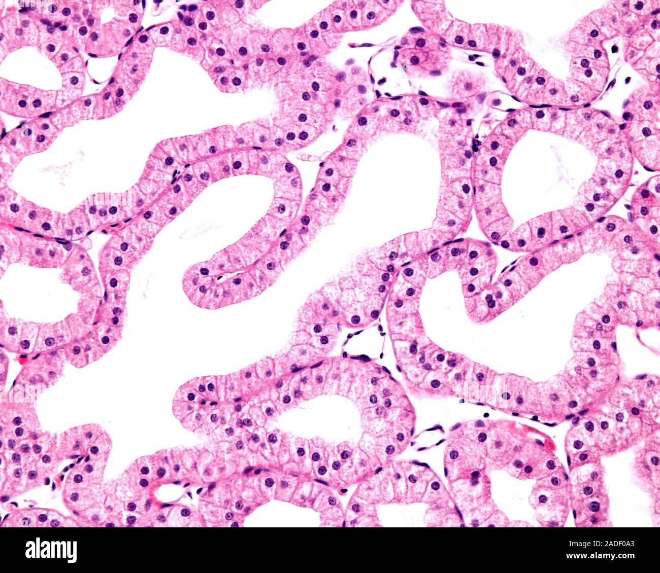 Light micrograph showing secretory units of a lacrimal gland. The ...