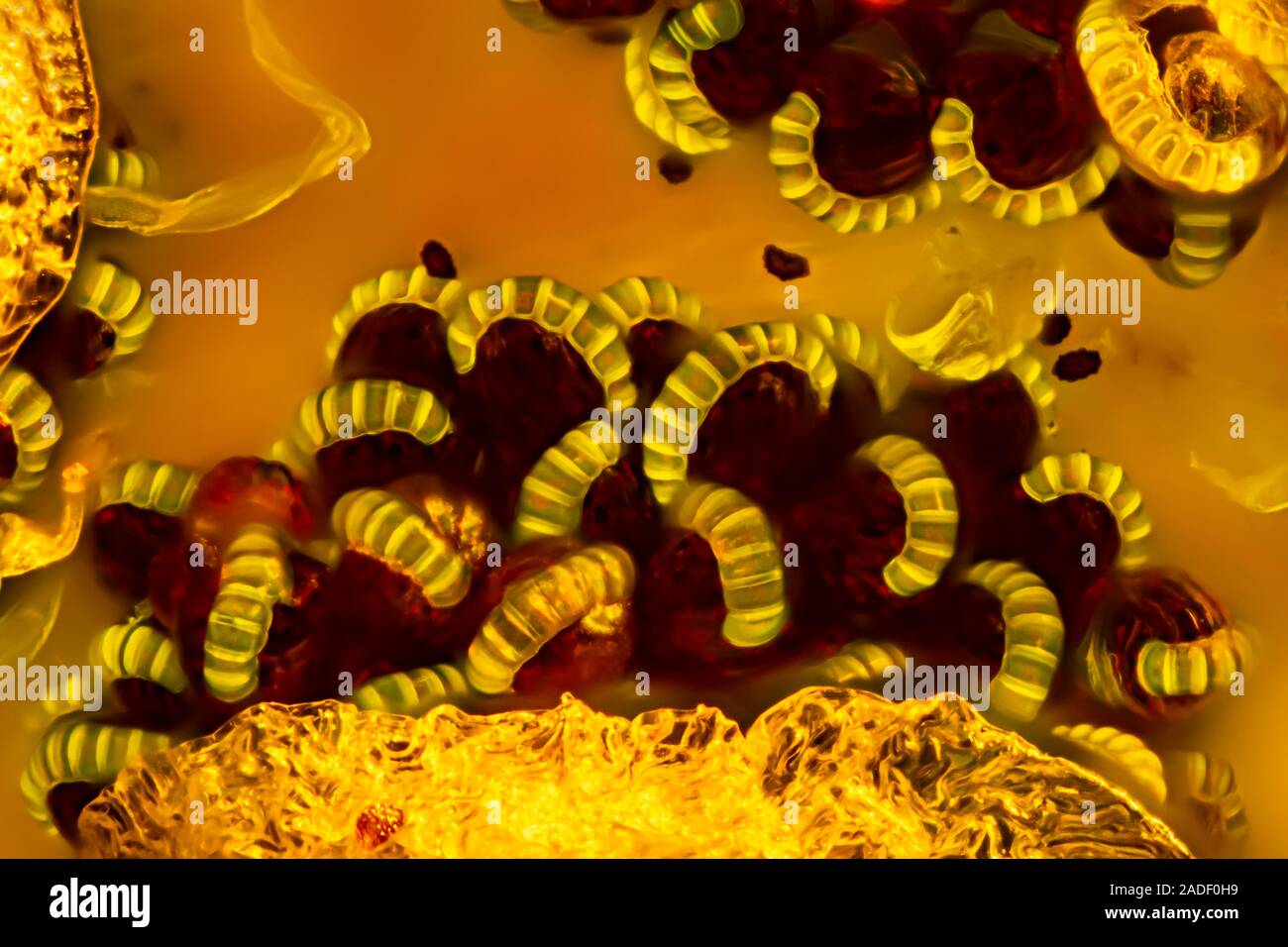 Fern sorus. Fluorescence light micrograph of a sorus on the underside ...