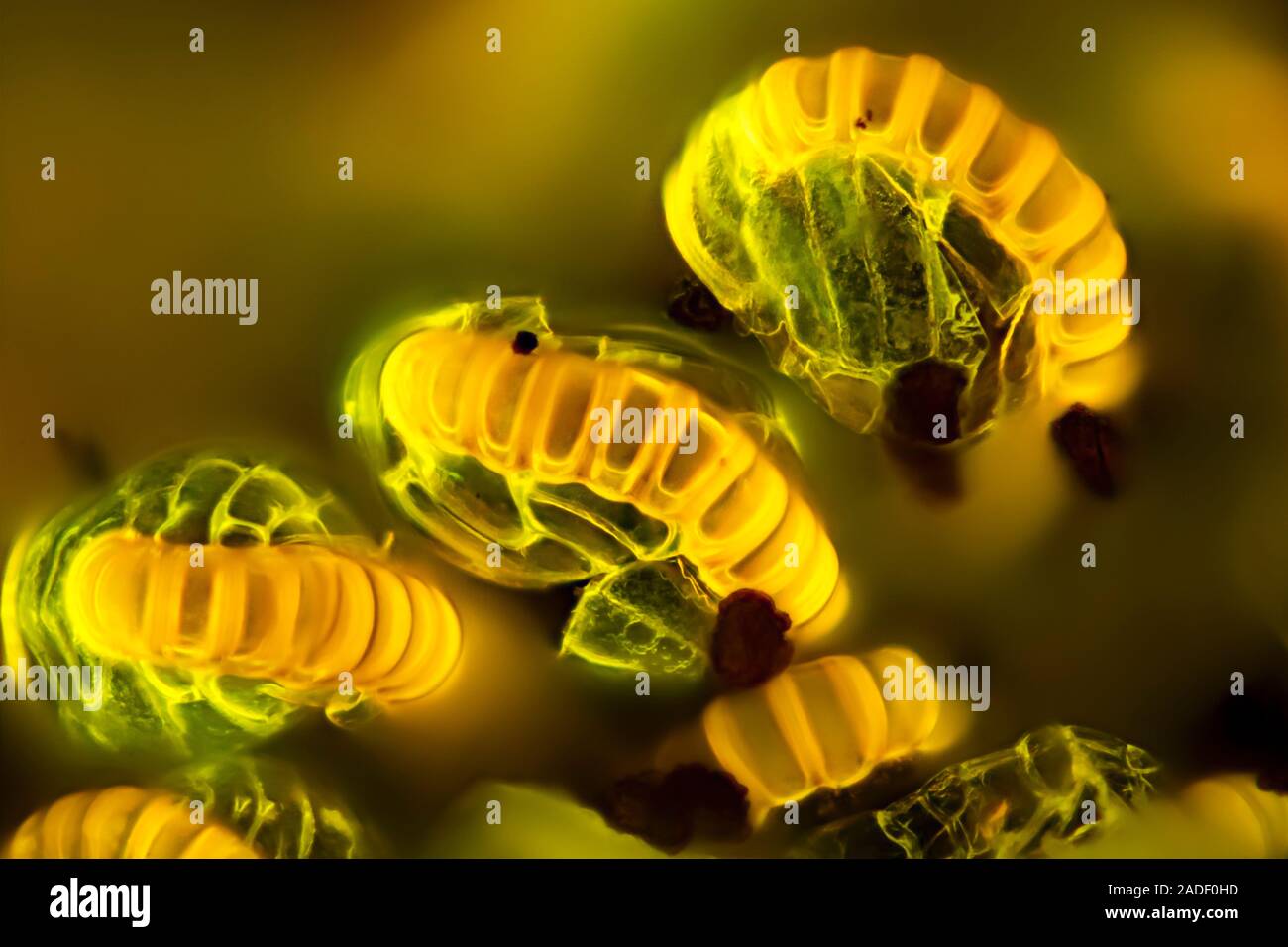 Fern sorus. Fluorescence light micrograph of a sorus on the underside ...