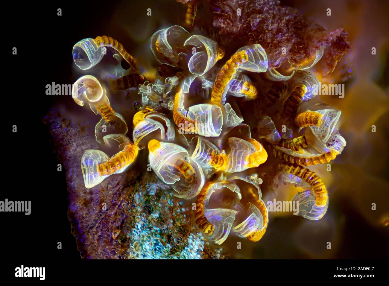 Fern sorus. Fluorescence light micrograph of a sorus on the underside ...