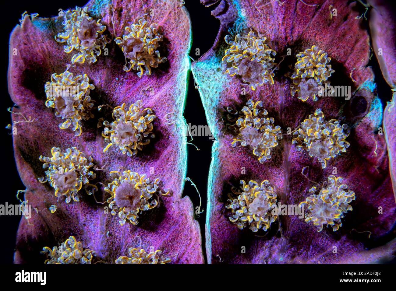 Fern sorus. Fluorescence light micrograph of a sorus on the underside ...