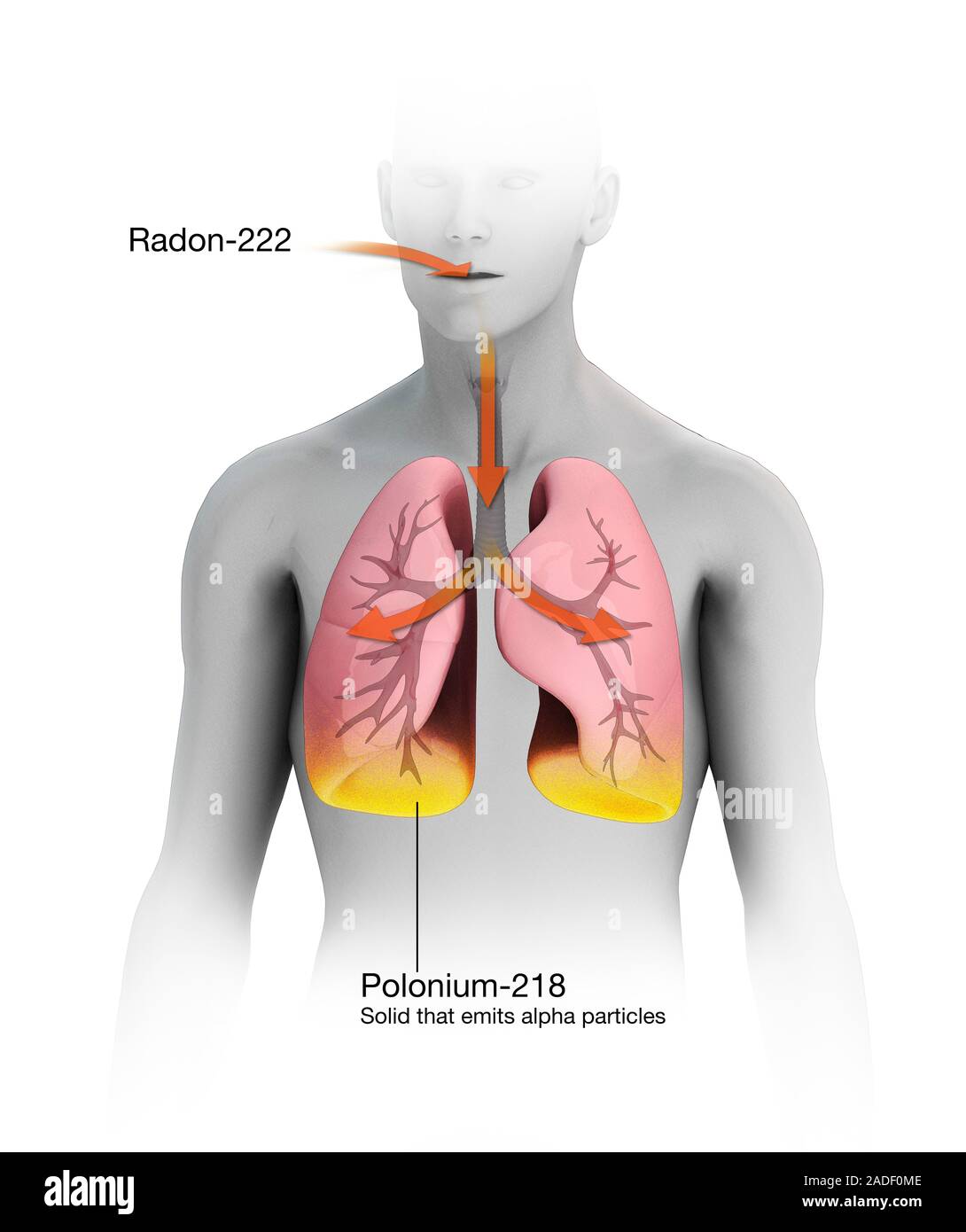 Radon decaying to polonium in humans, illustration. Radon is a chemical ...