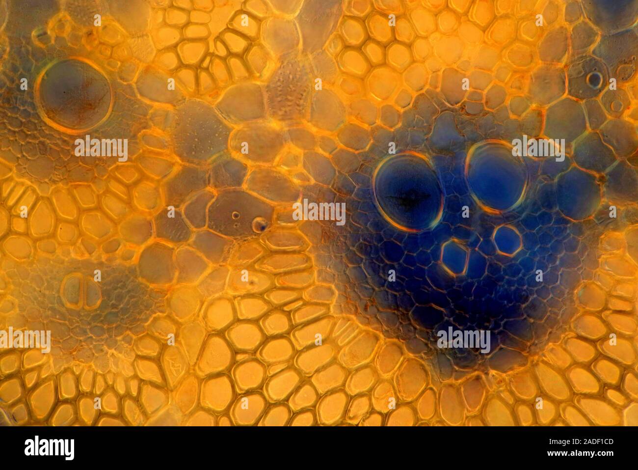 Banana stalk. Darkfield illuminated polarised light micrograph of a ...