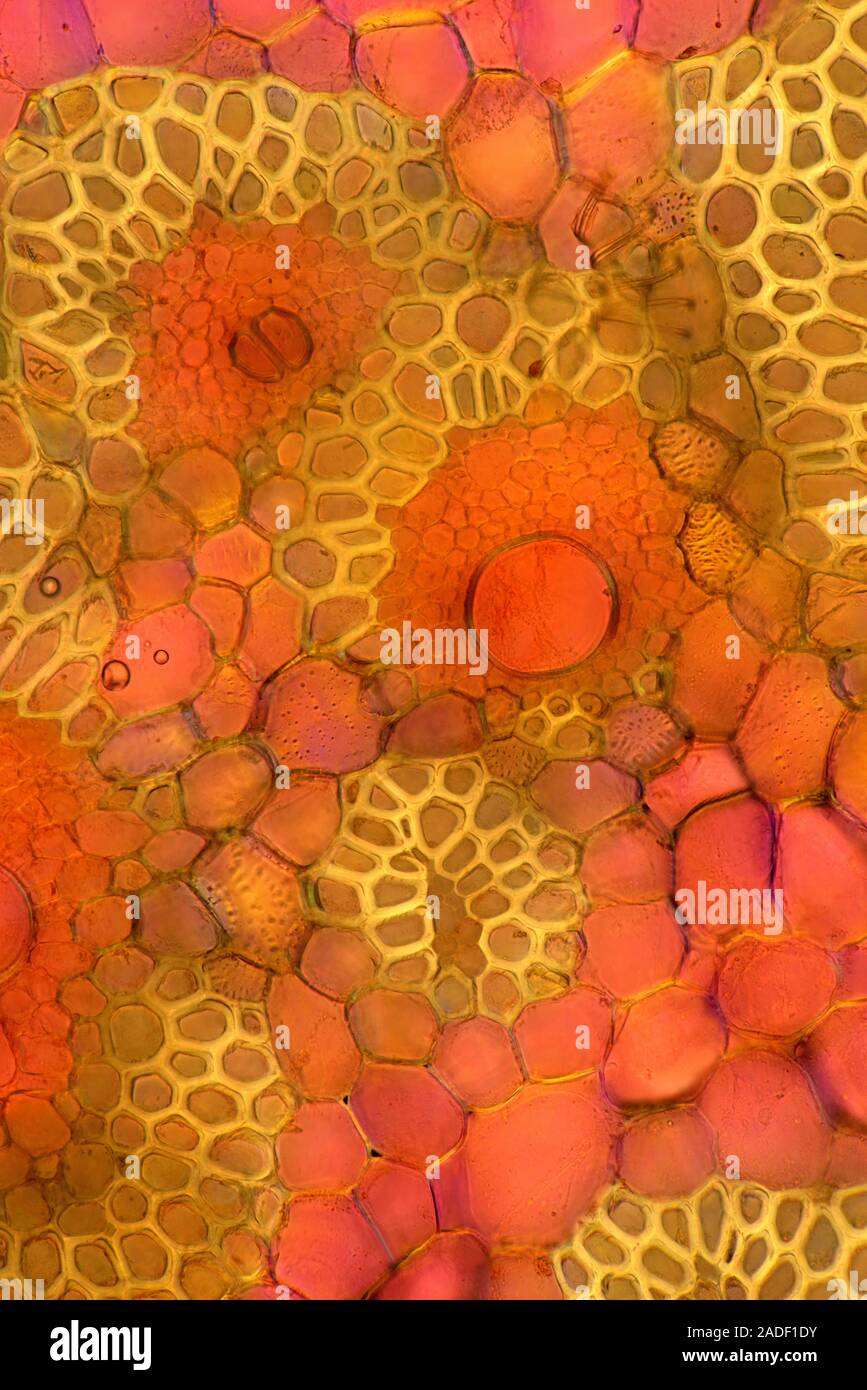 Banana stalk. Polarised light micrograph of a section through vascular ...