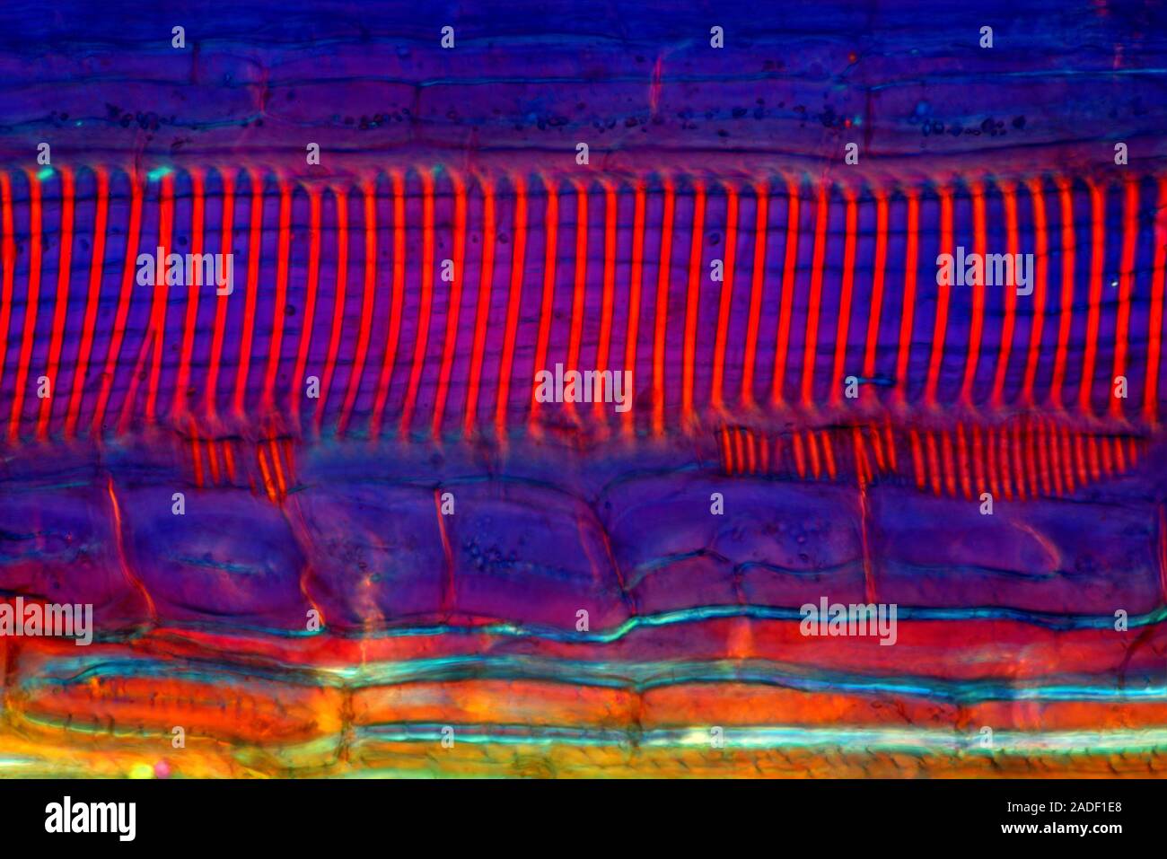 Banana stalk. Polarised light micrograph of a section through vascular ...