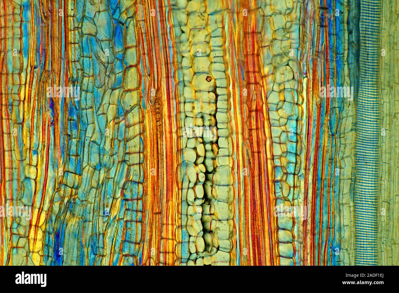 Banana stalk. Polarised light micrograph of a section through vascular ...