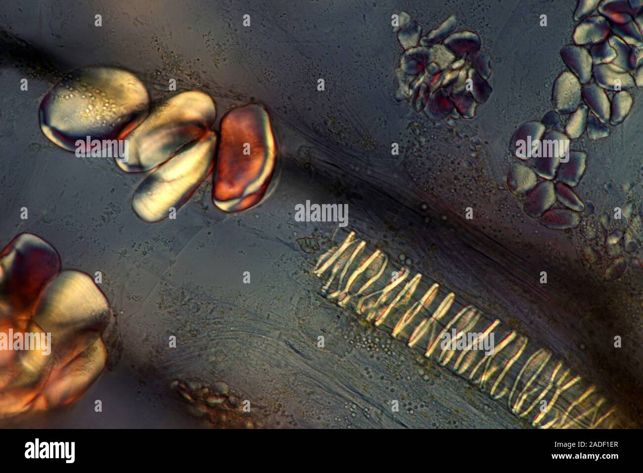 Banana starch grains. Polarised light micrograph of a section through ...