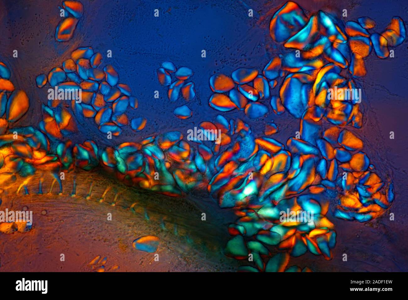 Banana starch grains. Polarised light micrograph of a section through ...