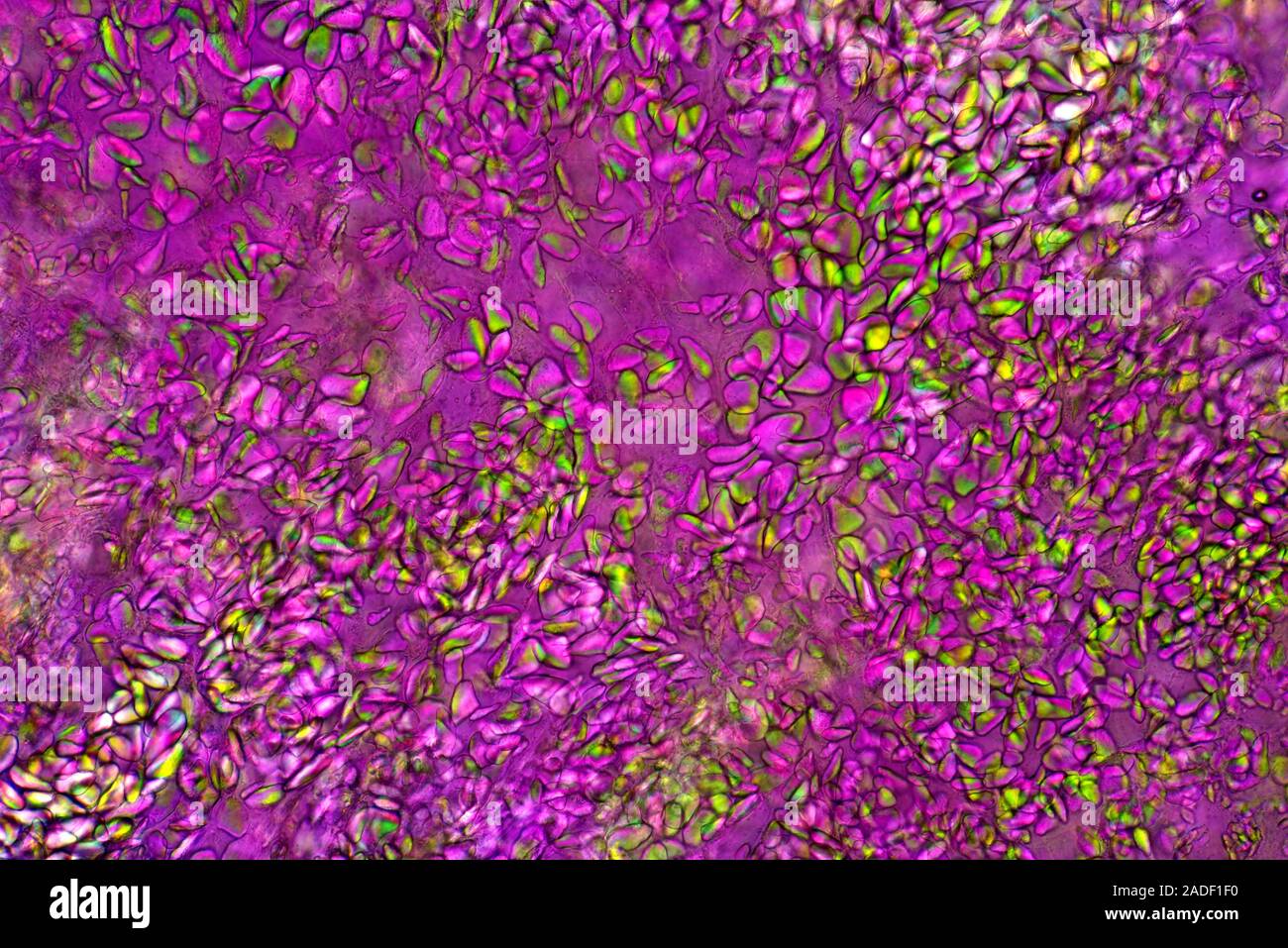 Banana starch grains. Polarised light micrograph of a section through ...