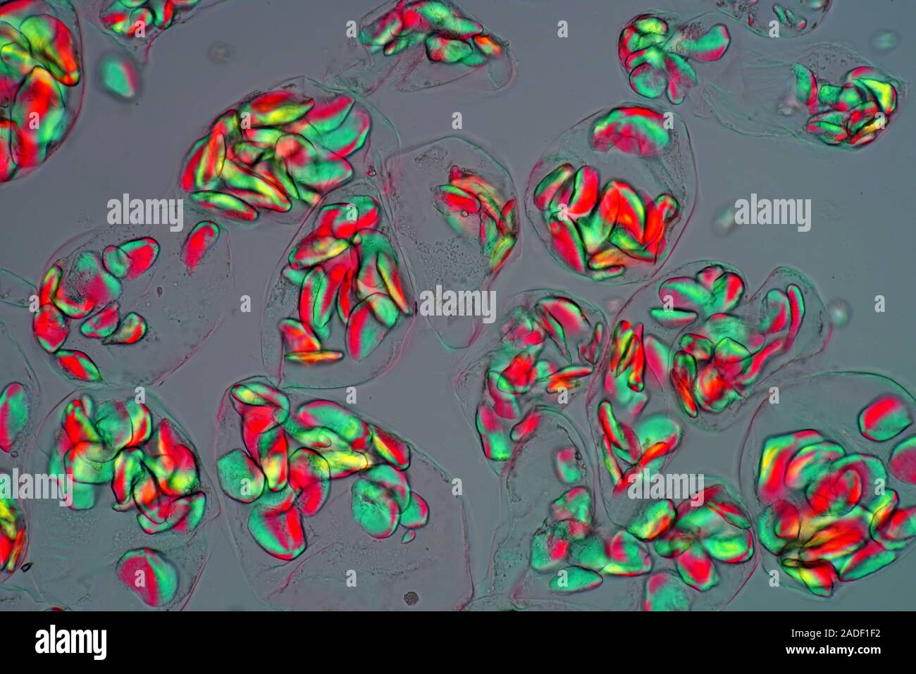 Banana starch grains. Polarised light micrograph of a section through ...