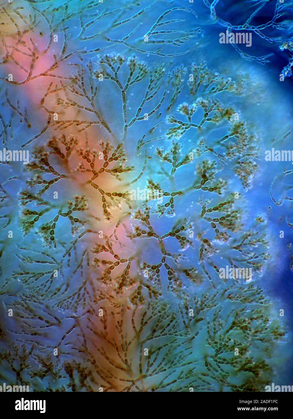 Batrachospermum red algae. Darkfield illuminated polarised light ...