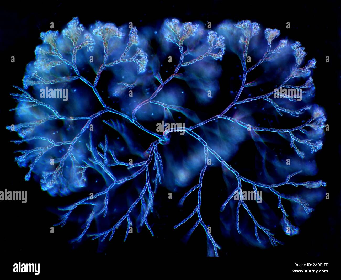 Batrachospermum red algae. Darkfield illuminated polarised light ...