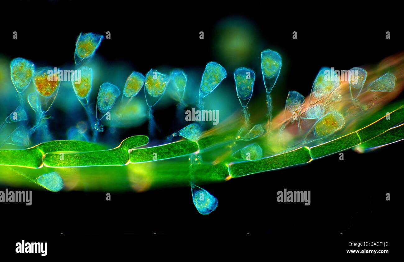 Suctorians on cladophora algae. Polarised light micrograph of a section ...