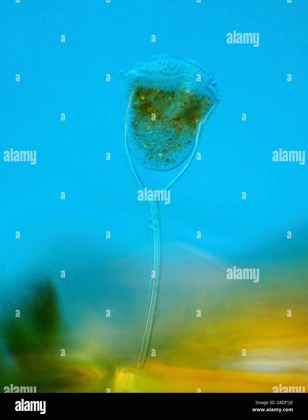 Suctorian protozoan. Polarised light micrograph of a section through a ...