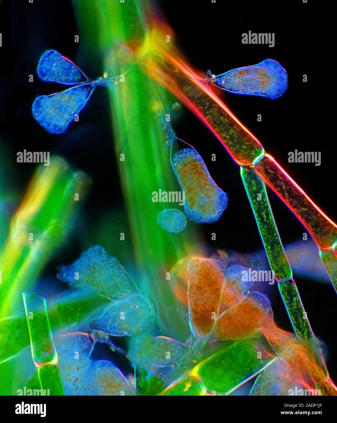 Suctorians on cladophora algae. Polarised light micrograph of a section ...