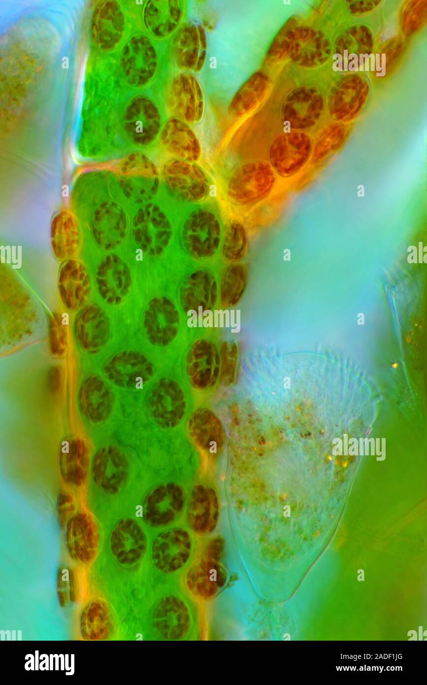 Diatoms on cladophora algae. Polarised light micrograph of a section ...