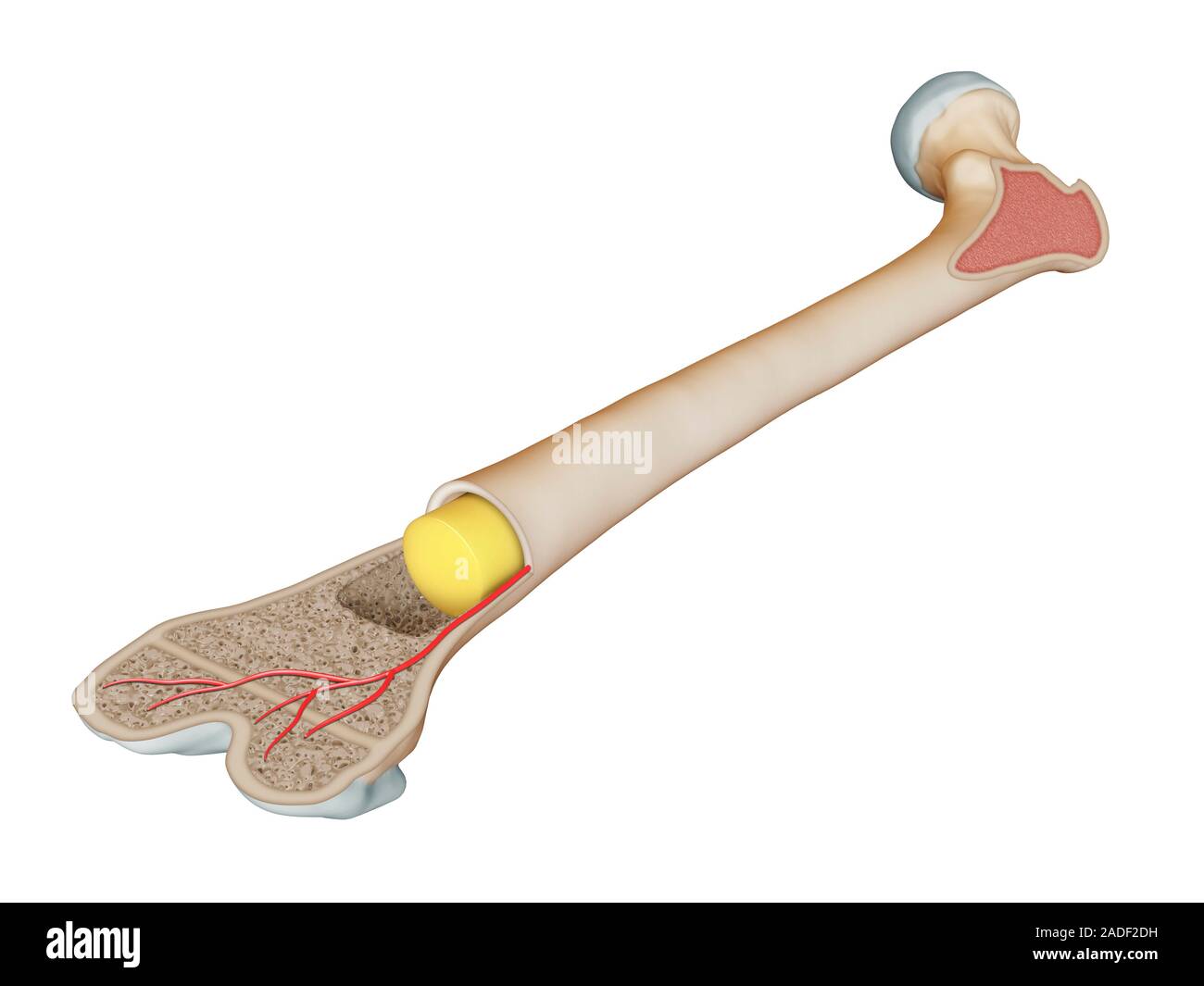 Bone marrow in a femur. Illustration of a sectioned upper leg bone ...