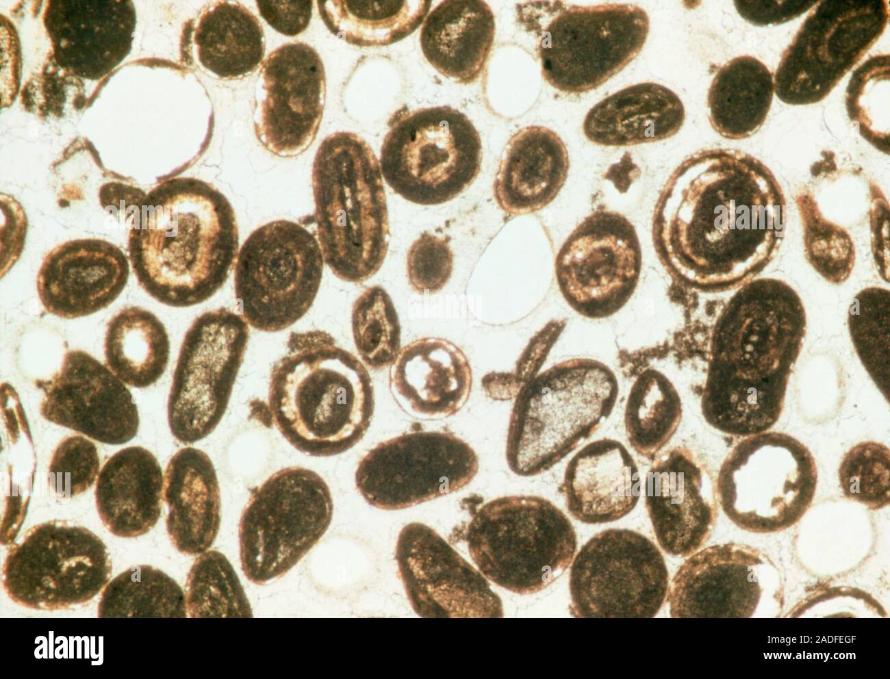 Oolite. Light micrograph of a thin section through limestone showing ...