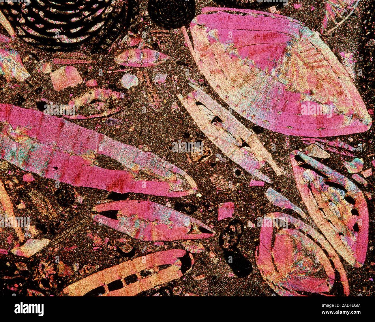Nummulitic limestone. Polarised light micrograph of a thin section of a ...