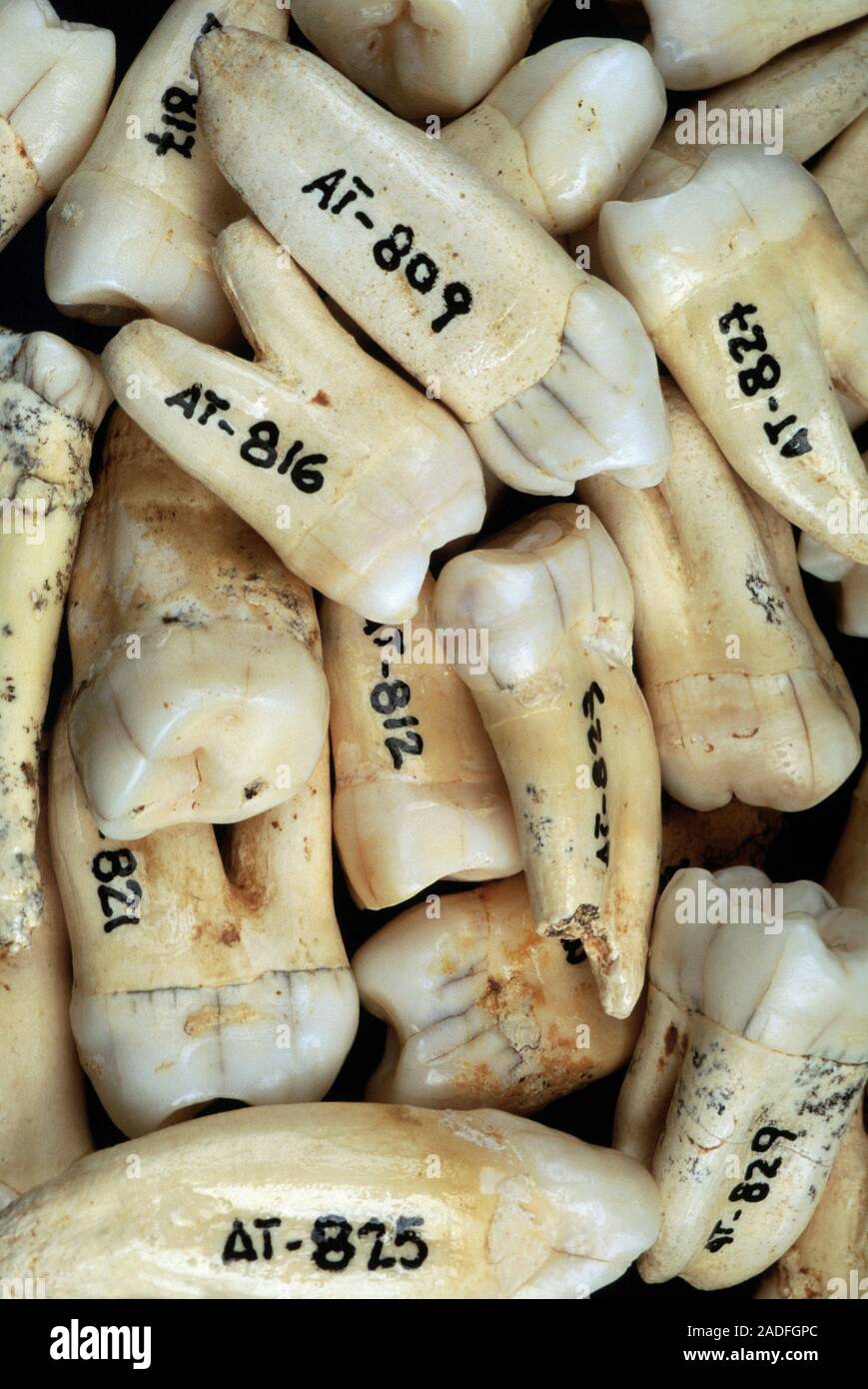 Fossilised teeth, Sima de los Huesos. These teeth were found at Sima de ...