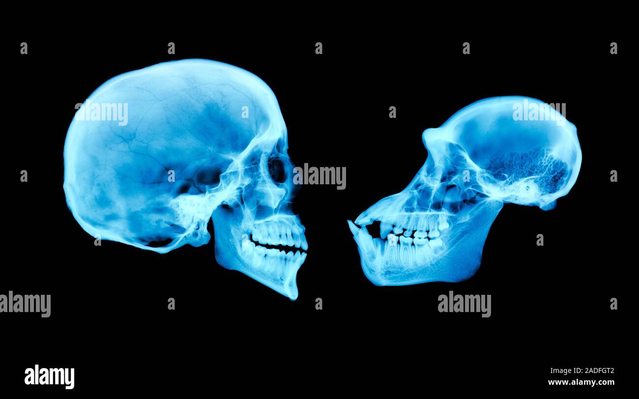 Human and chimpanzee skull. Coloured x-rays of the skulls of a human ...