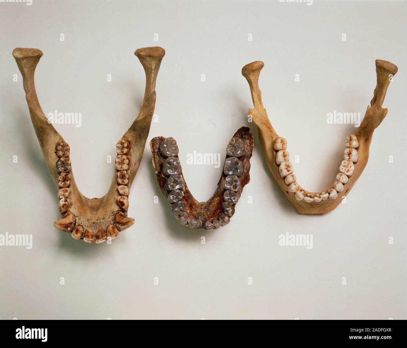 Comparison of the anatomy of three lower mandibles belonging to modern man (left), early man ...