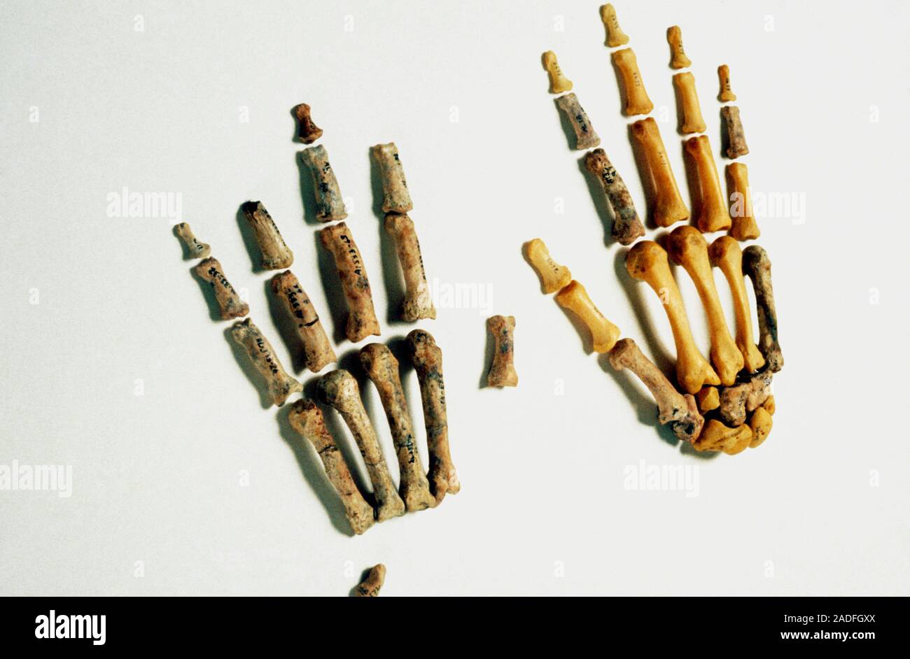 Comparing the fossil hand bones of the hominid Australopithecus ...