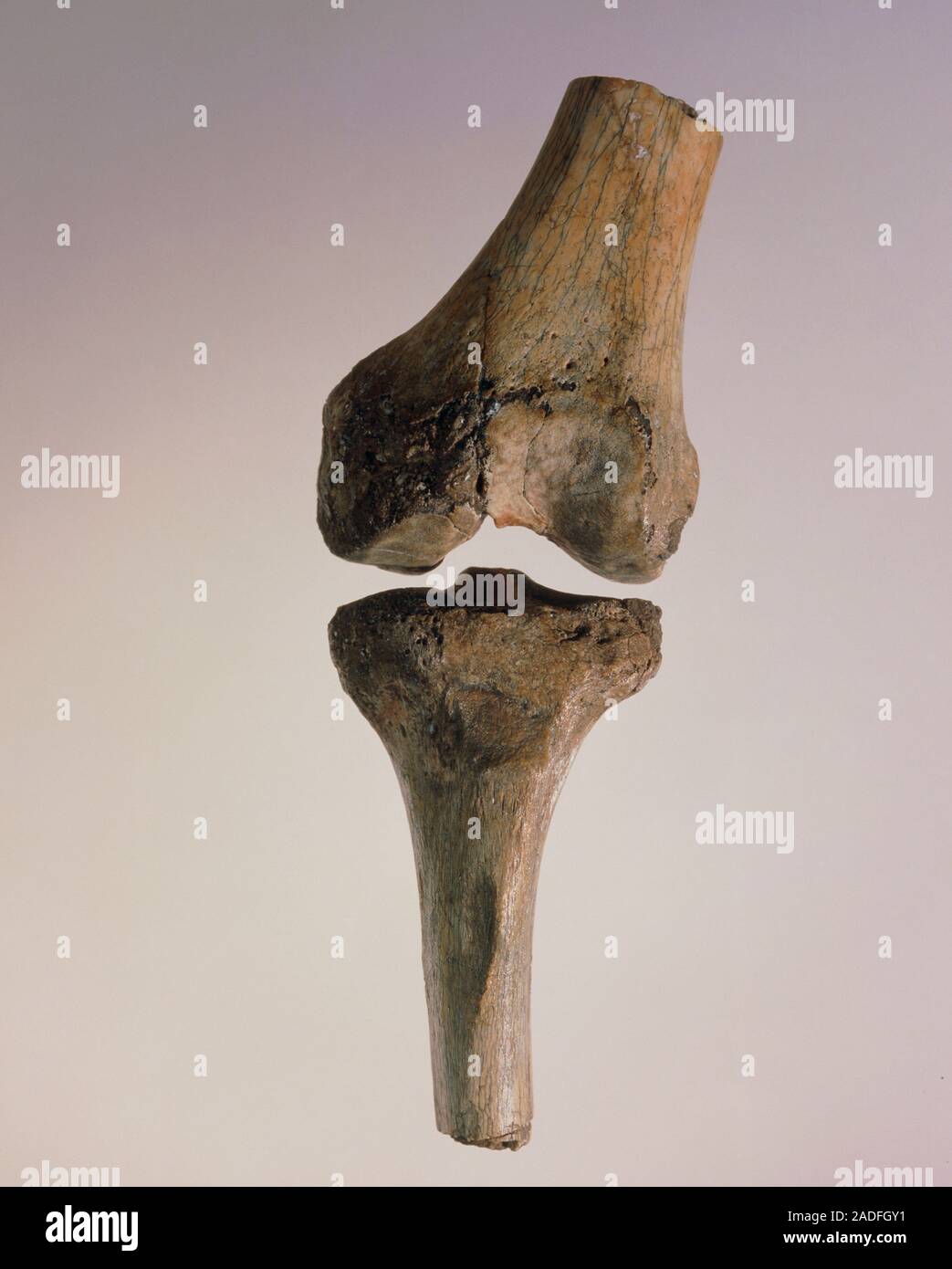 Australopithecus Anamensis Tibia