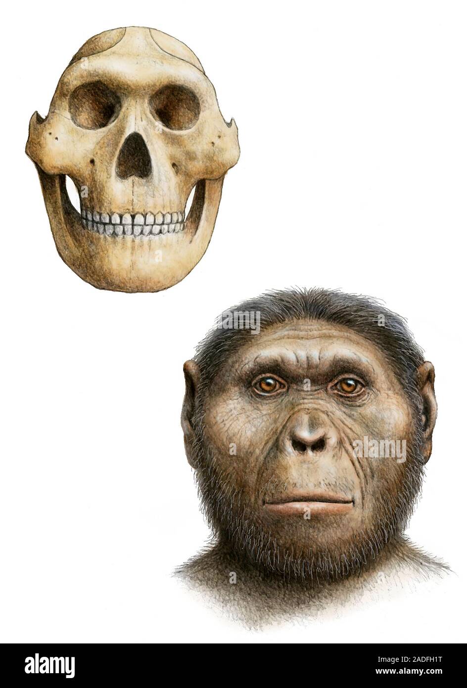 Paranthropus robustus. Artist's impression of the skull and face of the ...