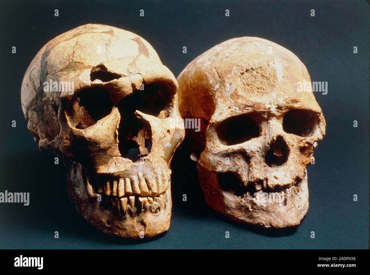 Neanderthal Skull Vs Human Skull
