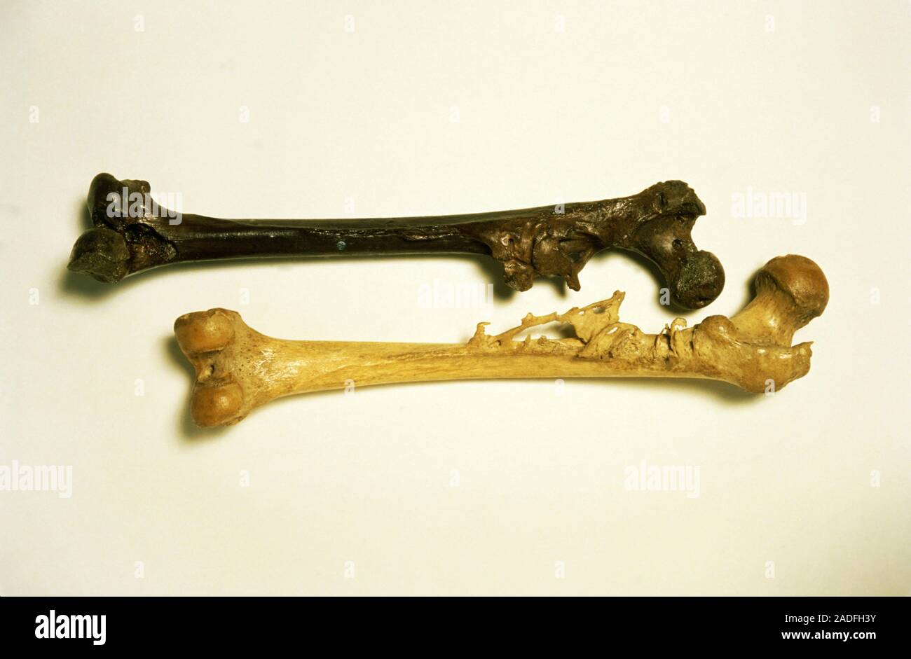 Comparison of bone disease in fossil man and contemporary man. The ...