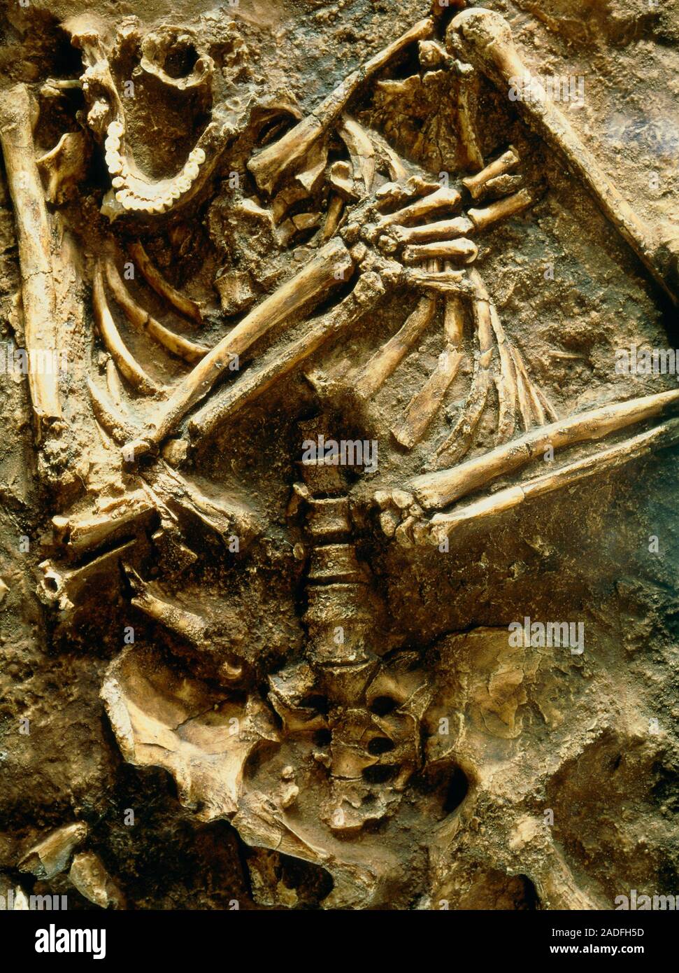 Neanderthal skeleton. View of the skeleton of a neanderthal (Homo ...
