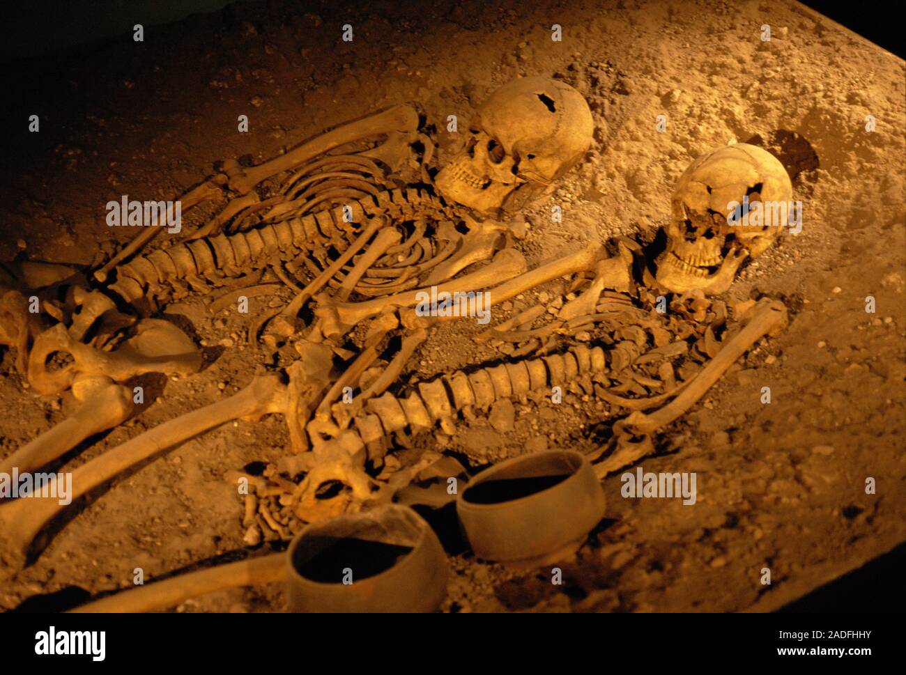 Skeletal remains. Excavated skeletons of British soldiers at Maiden ...