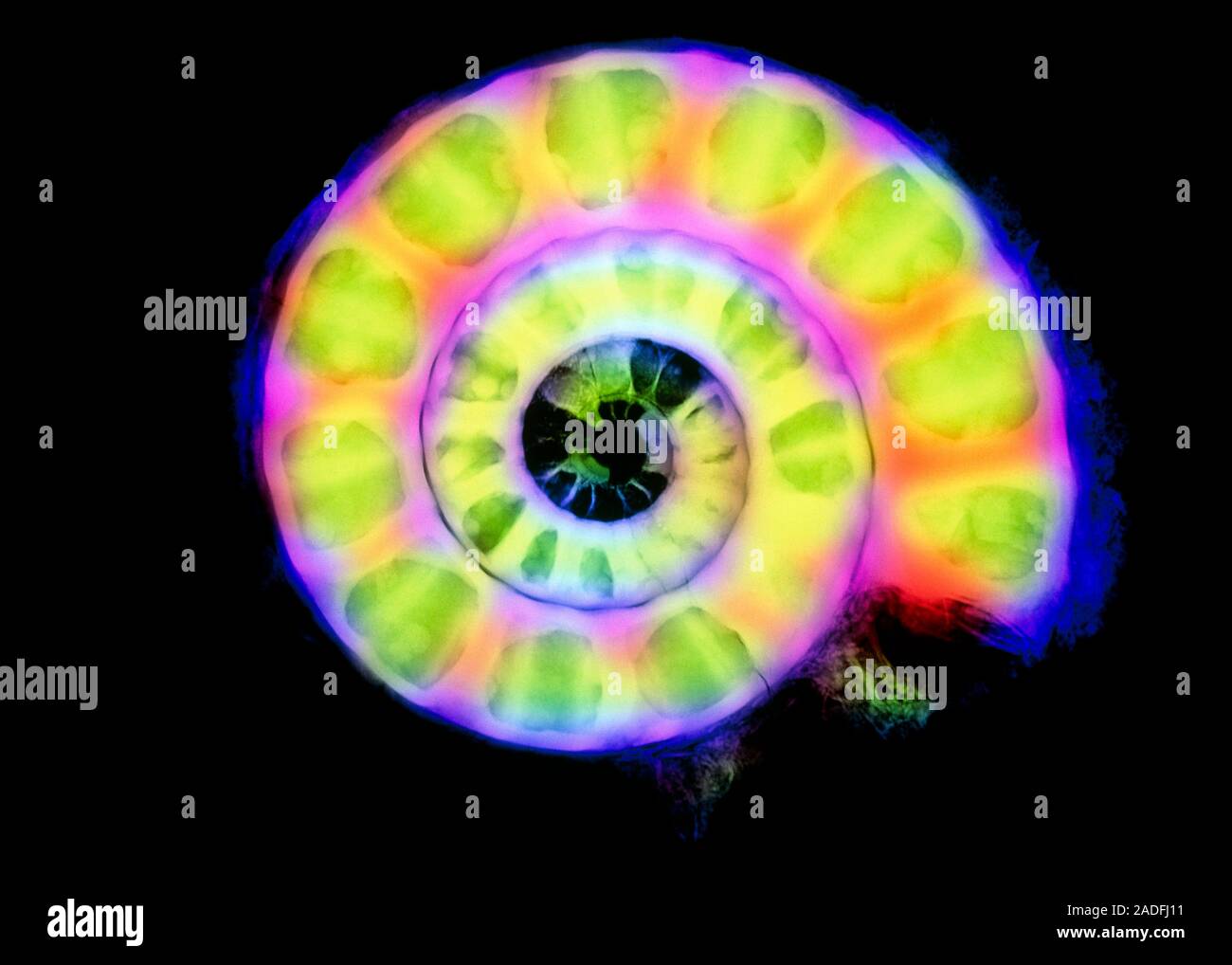 Ammonite shell. Coloured X-ray of a fossil ammonite showing the spiral ...