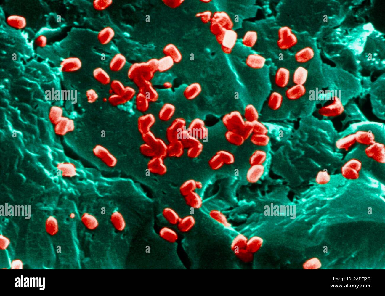 Fossilised bacteria. Coloured Scanning Electron Micrograph (SEM) of ...
