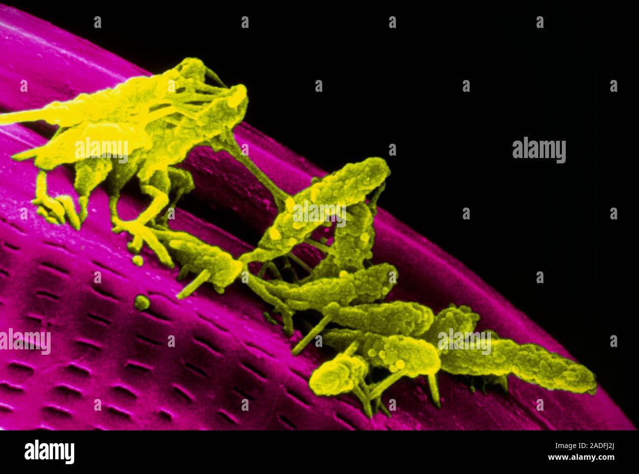 Fossilised bacteria. Coloured Scanning Electron Micrograph (SEM) of a ...