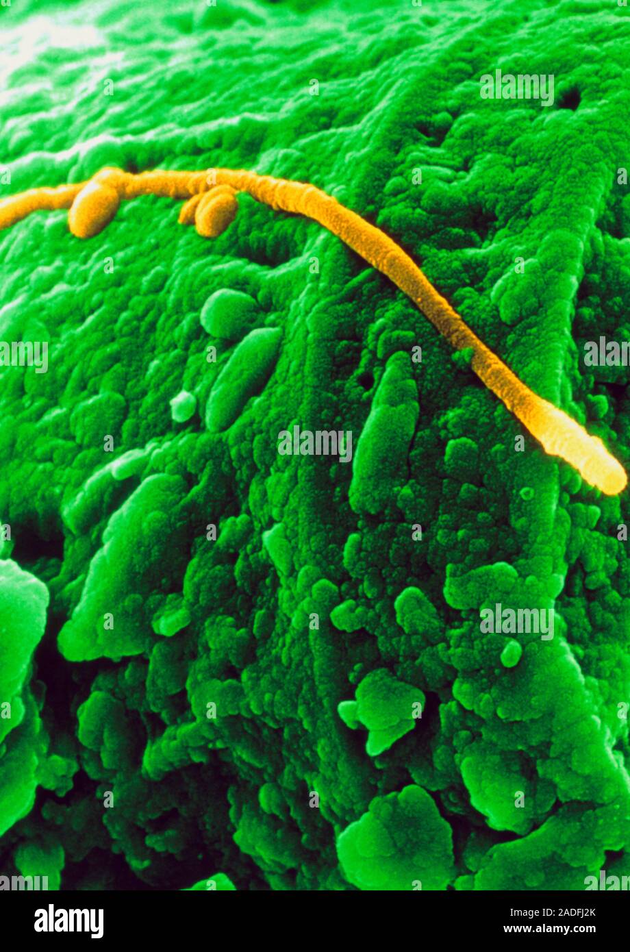 Fossilised bacteria. Coloured Scanning Electron Micrograph (SEM) of a ...