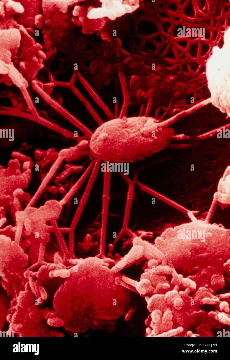 Fossilised bacteria. Coloured Scanning Electron Micrograph (SEM) of a ...