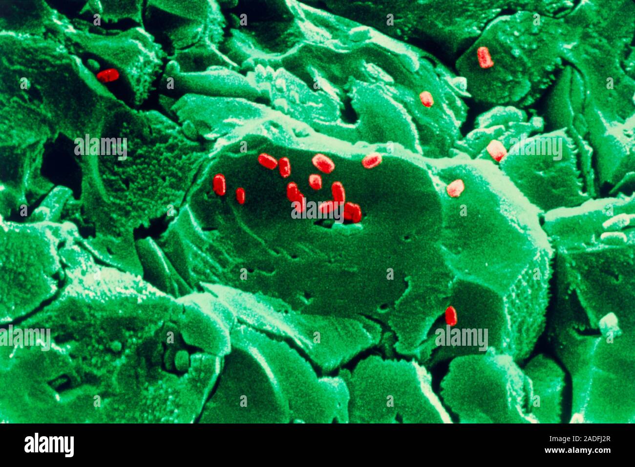 Fossilised bacteria. Coloured Scanning Electron Micrograph (SEM) of ...
