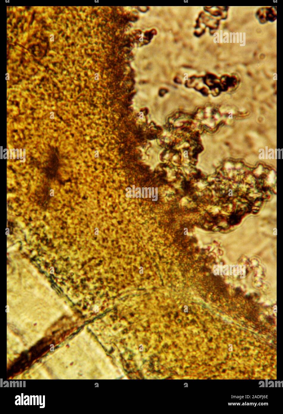 Bioaltered glass. Light micrograph of volcanic glass, showing granular ...