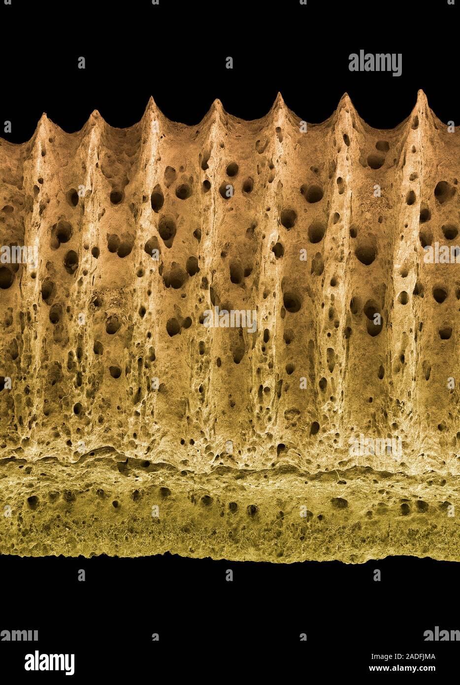 Fossilised ray tooth plate, coloured scanning electron micrograph (SEM ...