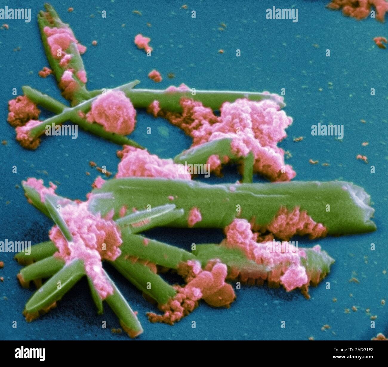 Exhaust particulate matter. Coloured scanning electron micrograph (SEM ...