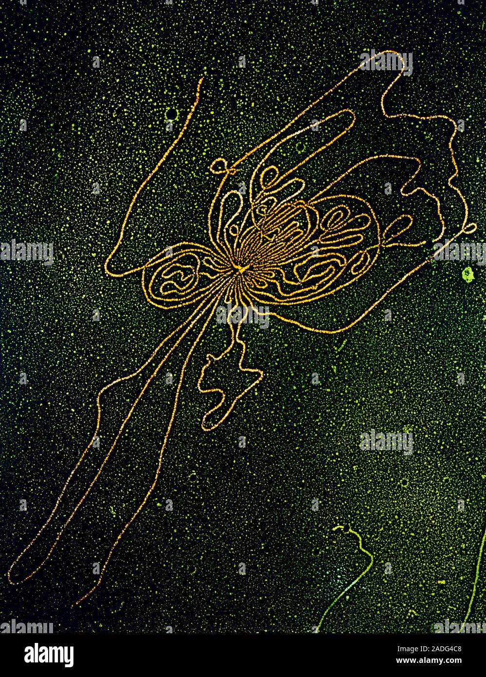 False colour transmission electron micrograph of a disrupted frog virus ...