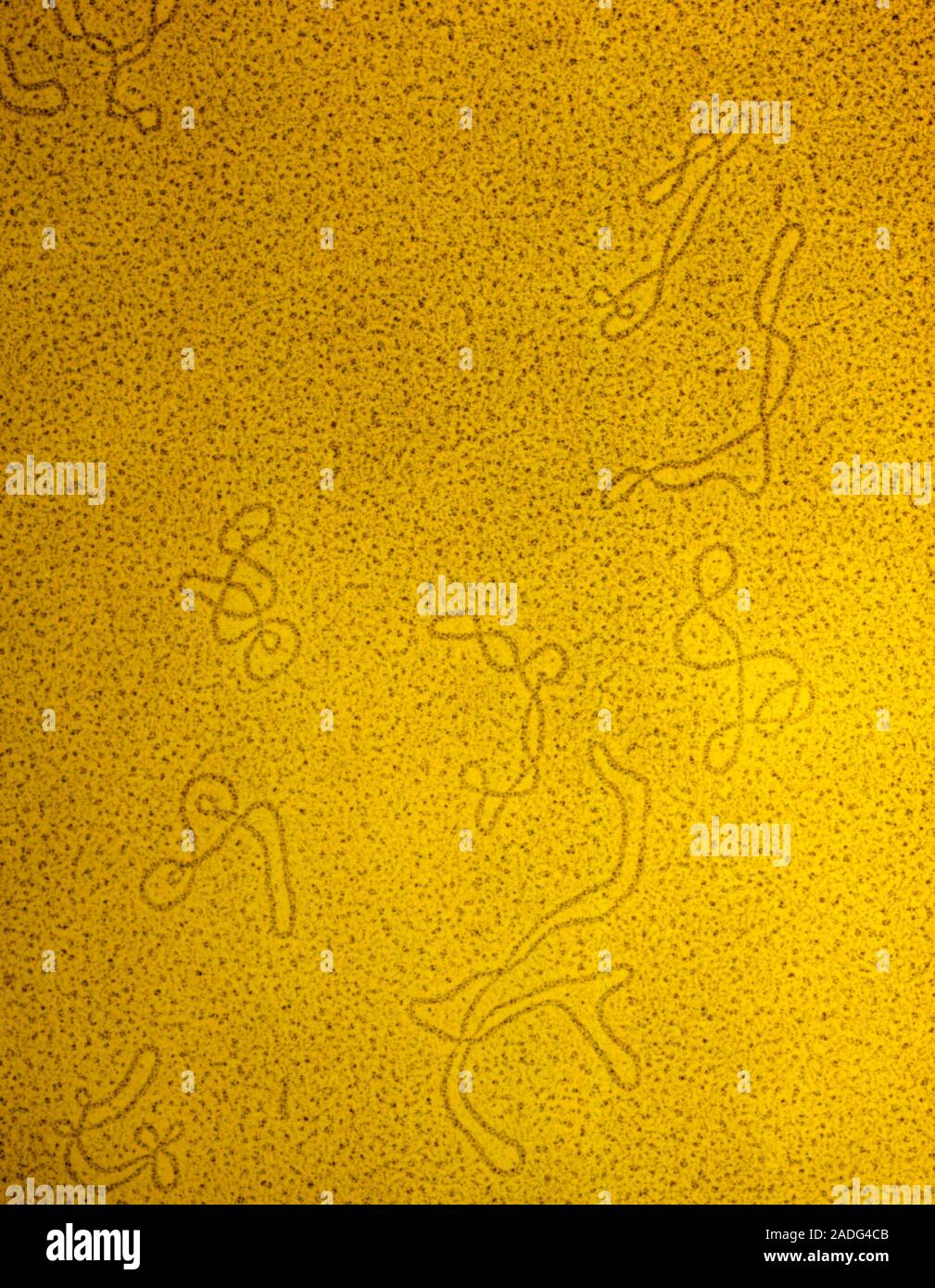 False Colour Transmission Electron Micrograph Of Plasmids Of Bacterial Dna From The Bacterium